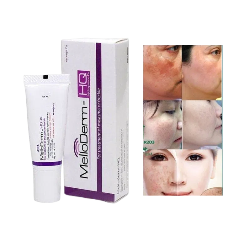 MelloDerm-HQ 4% giúp giảm nám tàn nhang, đồi mồi chính hãng