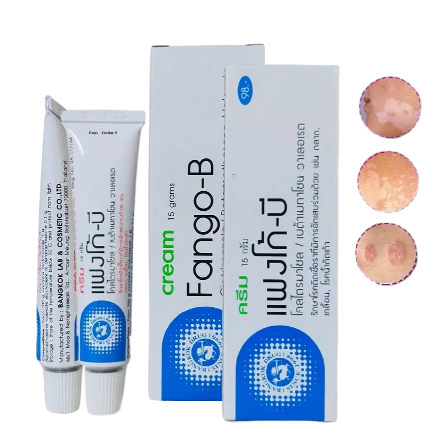Kem trị nấm da và lang ben Fango-B